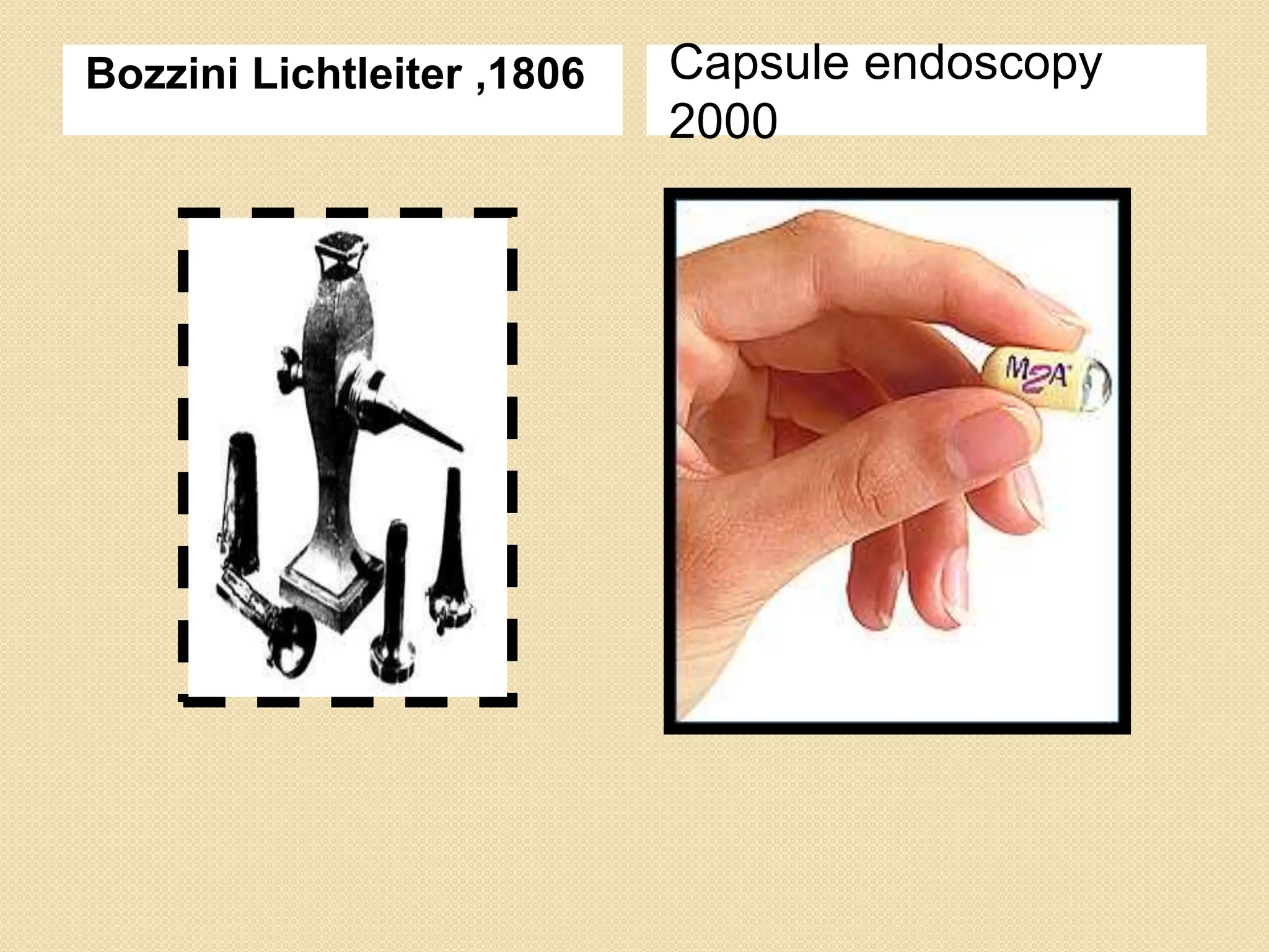 History of endoscopy ALEXEA by prof/ Ahmed Ellakanypptx | PPTX