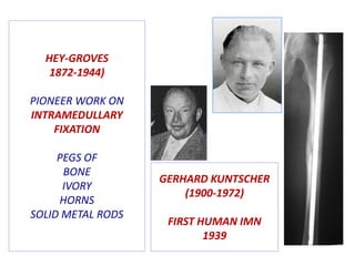 History of fracture fixation part 1 | PPTX