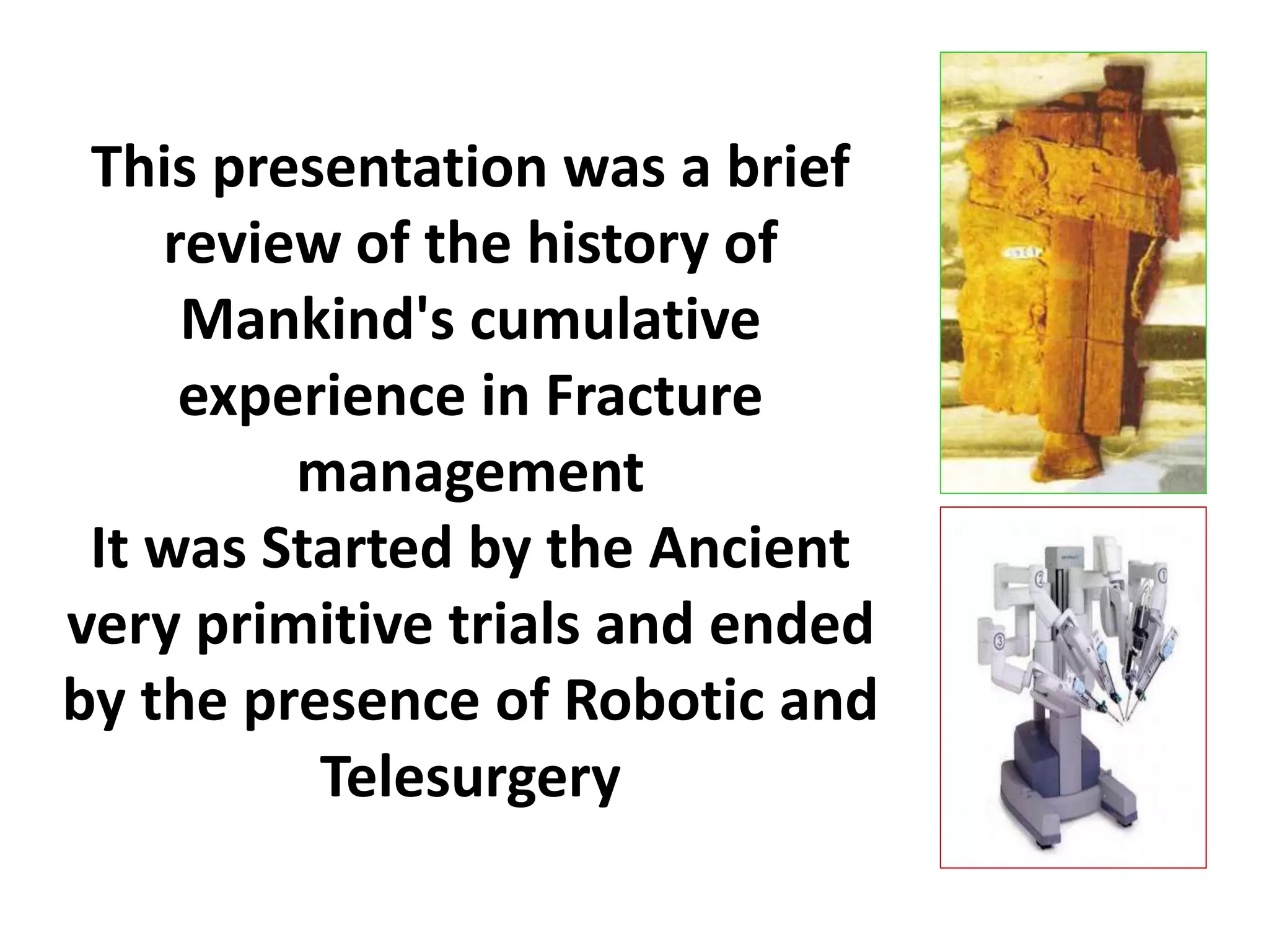 History of fracture fixation part 2 | PPTX