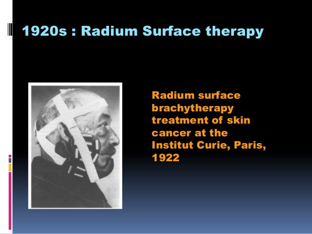 History of ionizing radiation