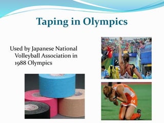 History of kinesio taping | PPTX