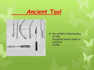 History of medicine of ancient india | PPTX