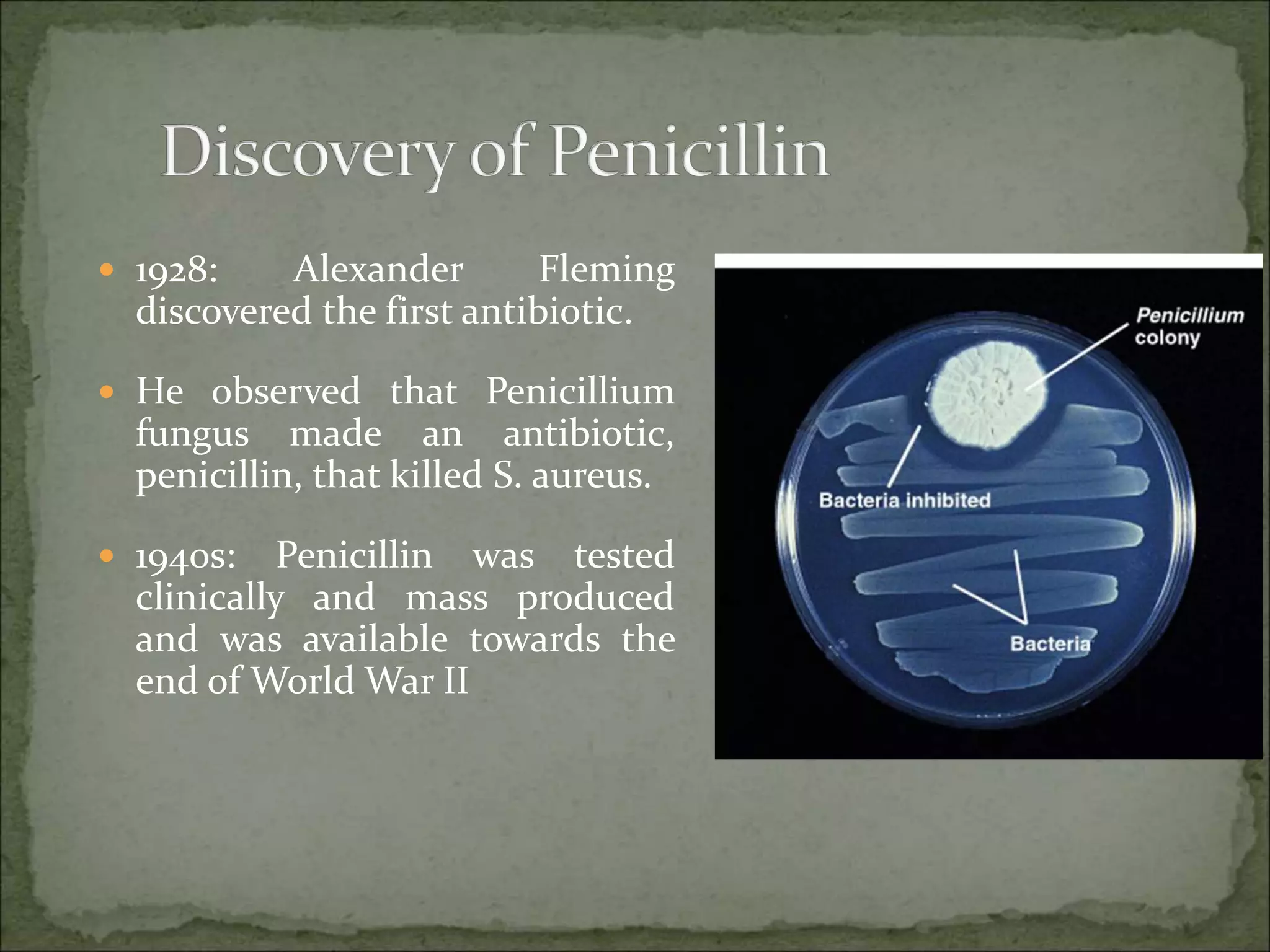 History of microbiology | PPT
