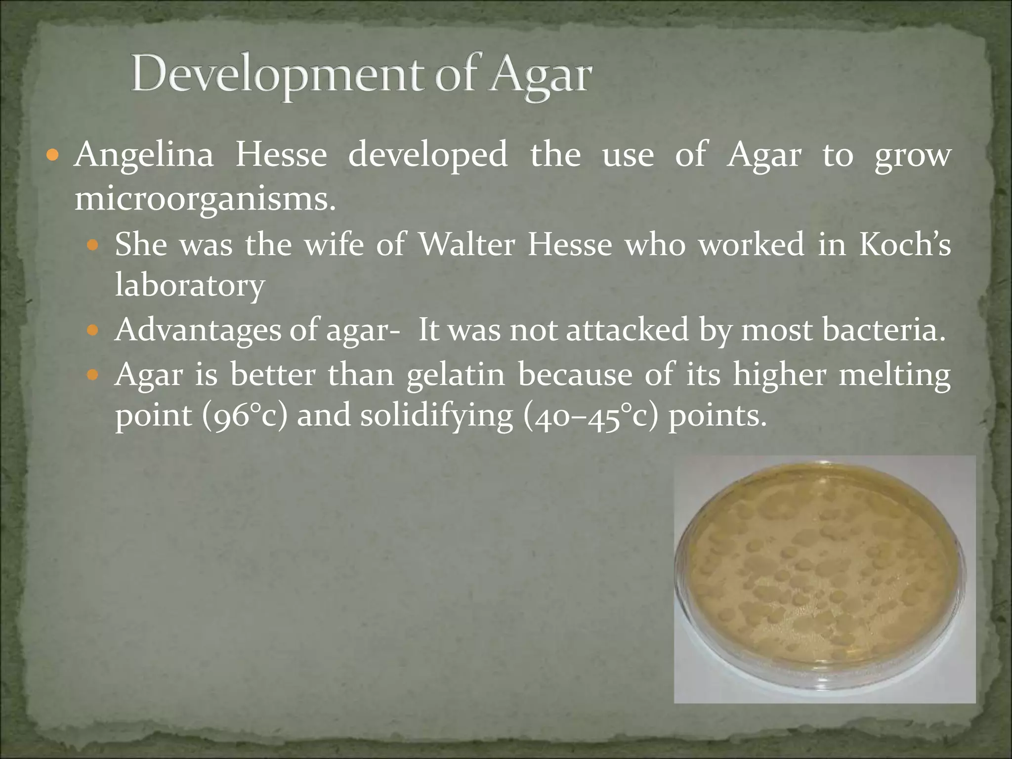 History of microbiology | PPT