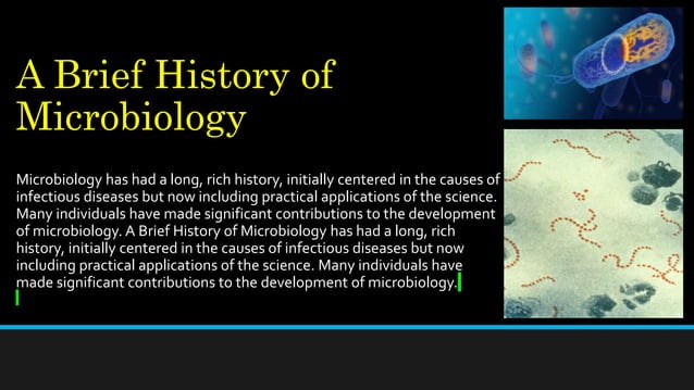 History of microbiology | PPT