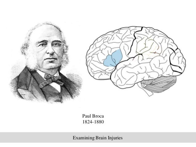 A (Short) History of the Human Brain