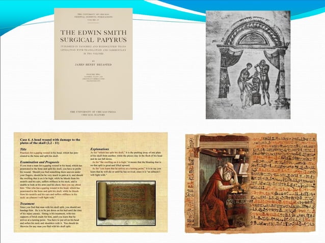 History of Neurosurgery superspeciality | PPTX