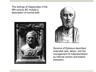 History of obstetrics | PPTX