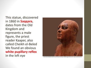 History of Ophthalmology in Egypt | PPTX | Eye and Vision Conditions ...