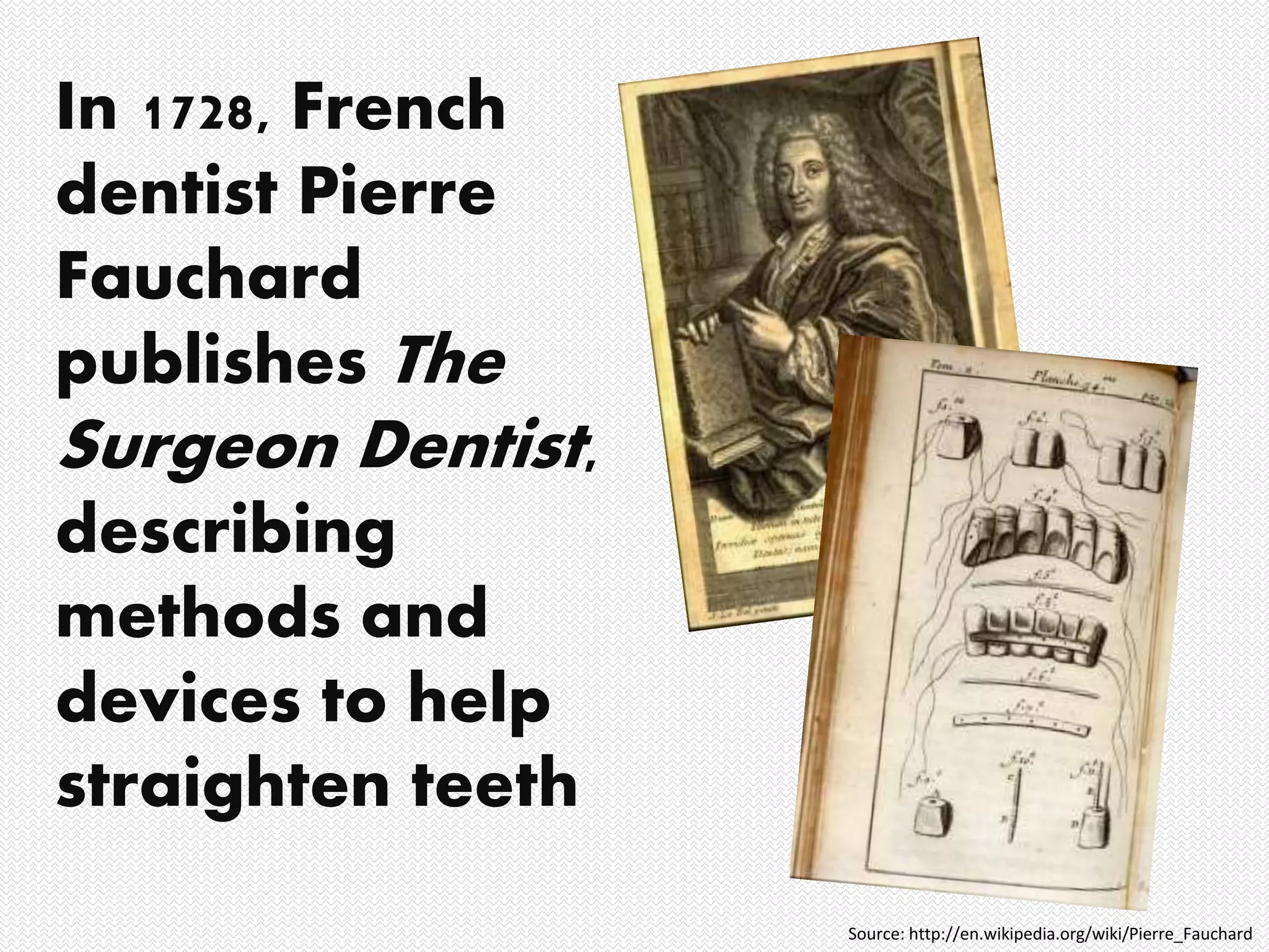 A Short History of Orthodontic Braces | PPTX