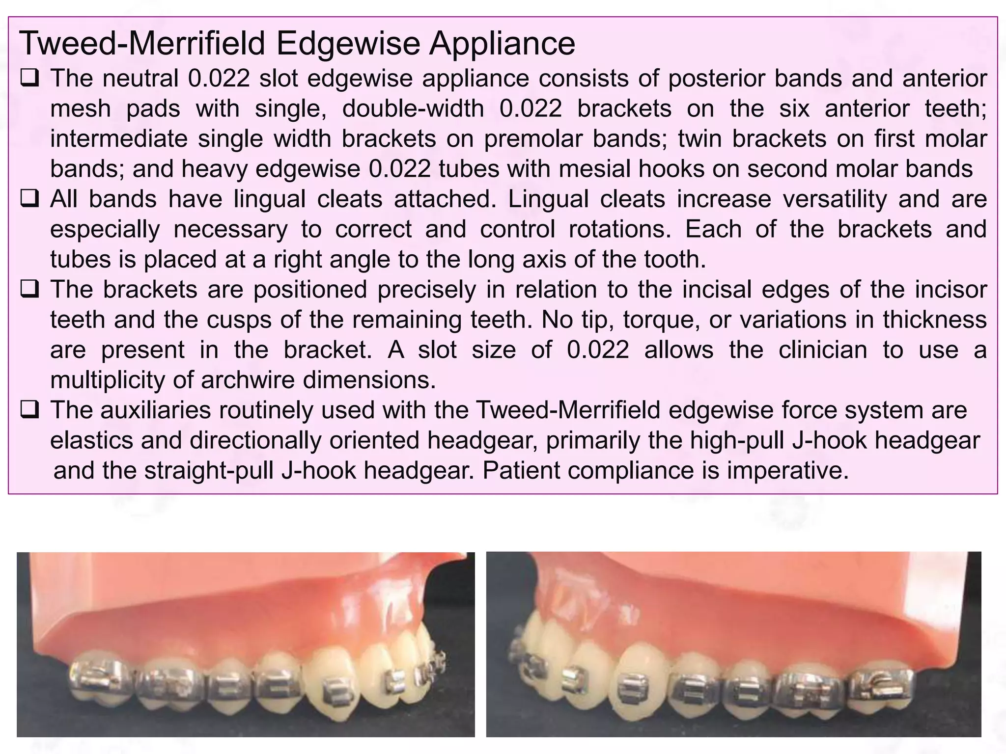 History of orthodontics | PPTX