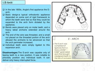 History of orthodontics | PPTX