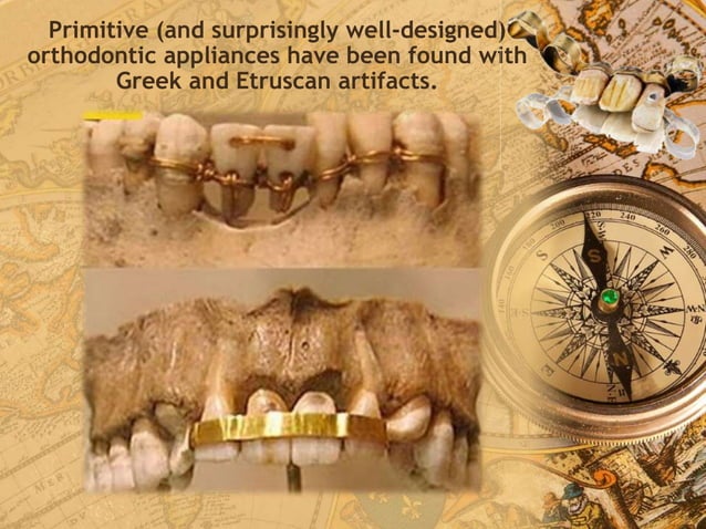History of orthodontics | PPTX | Dental Health | Diseases and Conditions