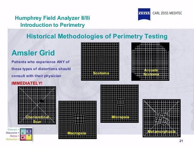 History of perimetry