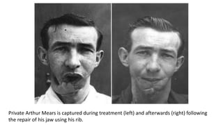 History of plastic, reconstructive and aesthetic surgery in Kenya | PPTX