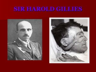 History Of Plastic Surgery | PPT