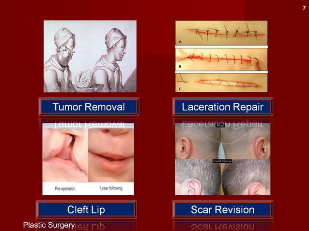 History of plastic surgery ., shushruta plastic surgery , indian ...