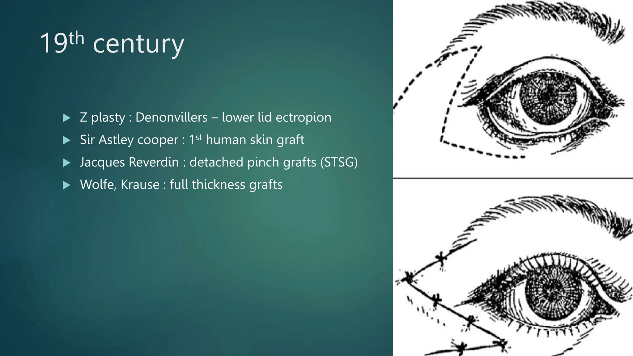 history of plastic surgery.pptx is brief history throh various ...