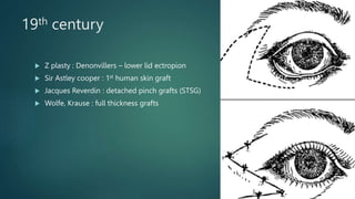 history of plastic surgery.pptx is brief history throh various ...