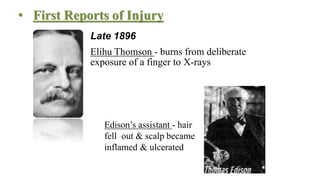 history of radiation & dosimeter and SOA.pptx