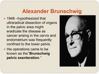 History of radical hysterectomy for cancer cervix | PPTX