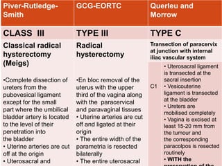 History of radical hysterectomy for cancer cervix | PPTX