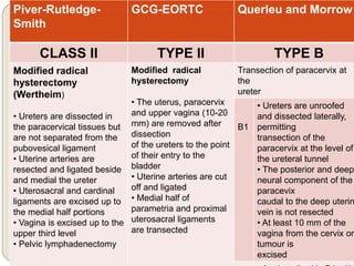History of radical hysterectomy for cancer cervix | PPT