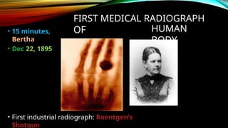 History of Radiology History of Radiology | PPTX