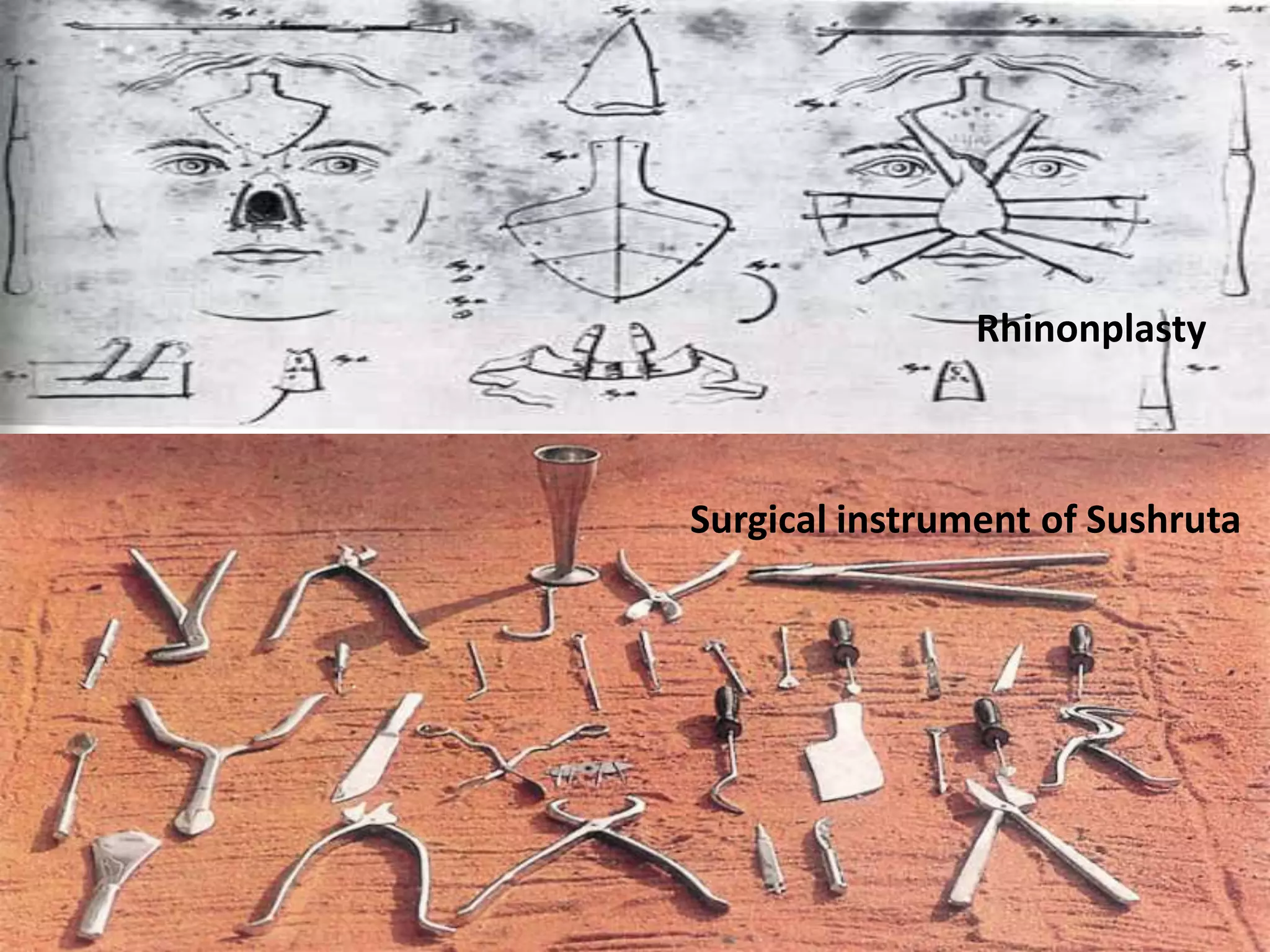 History of surgery | PPTX