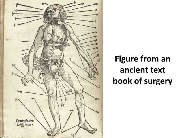 History of surgery | PPTX