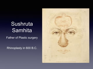 History of surgery | PPTX