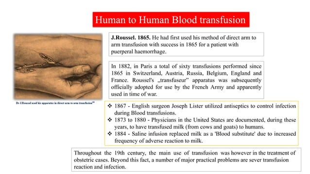 History of blood transfusion.pptx | Blood Disorders | Diseases and ...