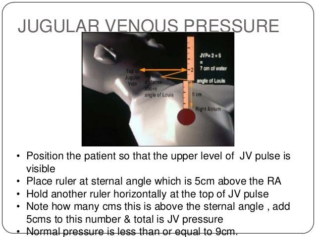 History & physical examination of cvs