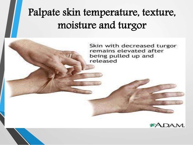 General History taking and physical examinatin