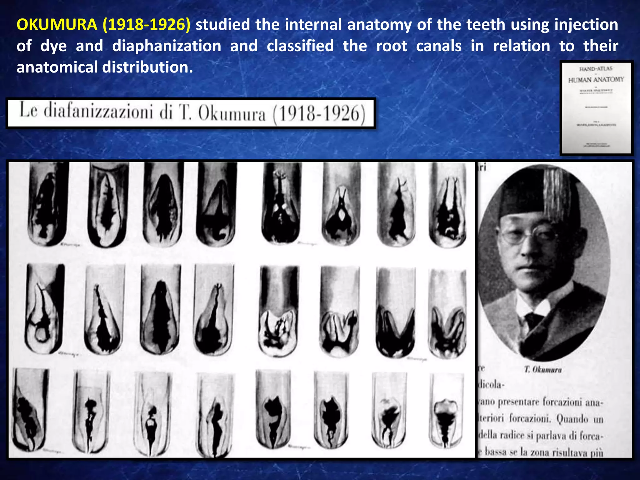 A Brief History of the First Studies on the Root Canal Anatomy | PPTX