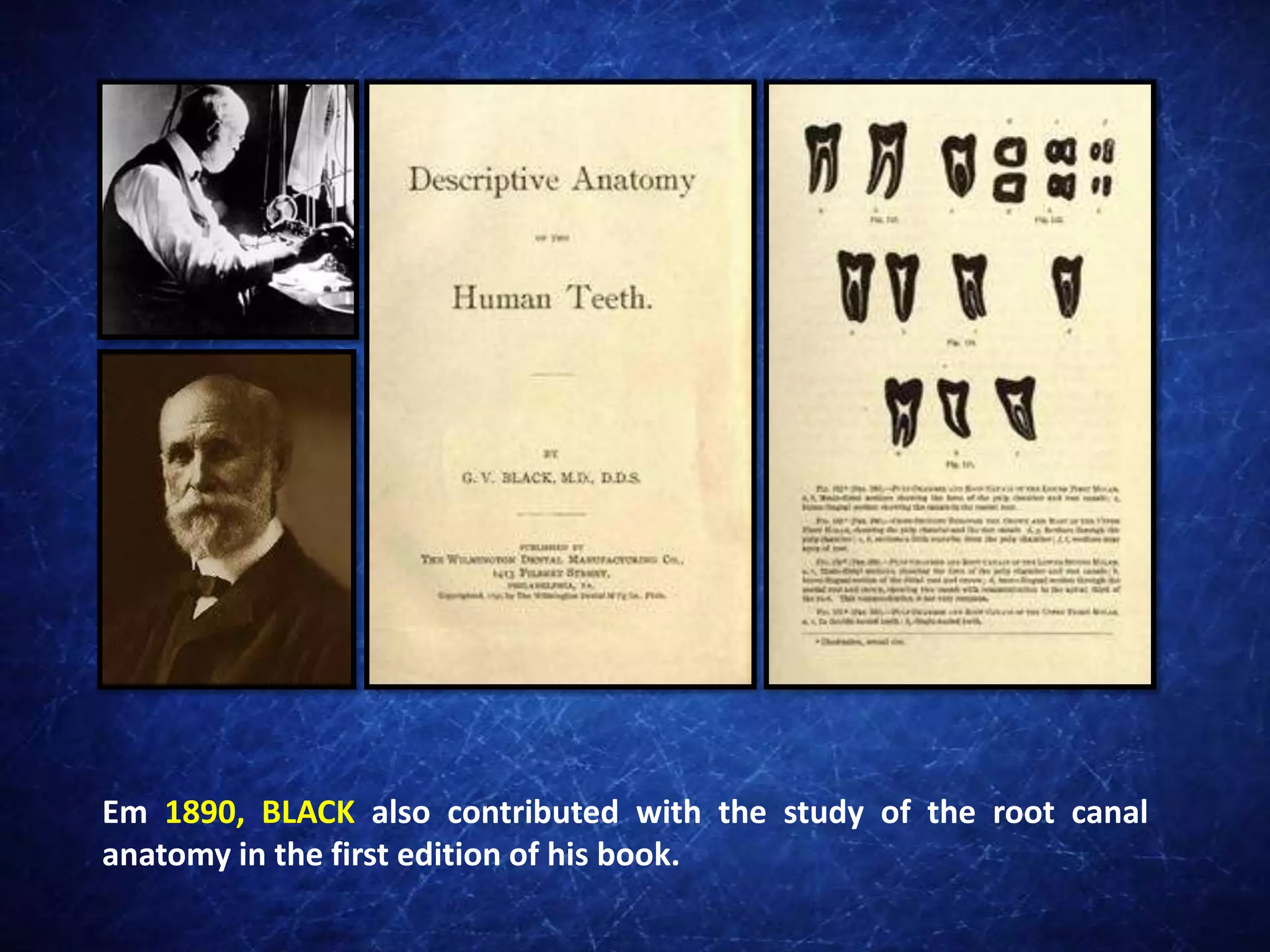 A Brief History of the First Studies on the Root Canal Anatomy | PPTX