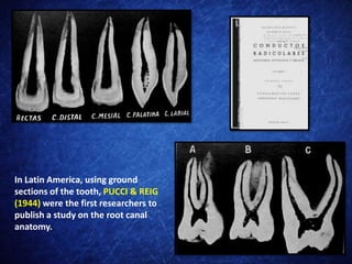 A Brief History of the First Studies on the Root Canal Anatomy | PPTX