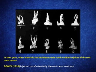 A Brief History of the First Studies on the Root Canal Anatomy | PPTX