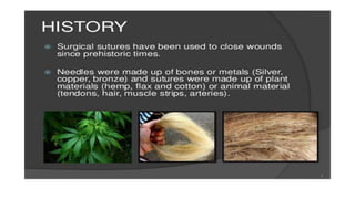 History Suture and how it has impact on surgery | PPTX