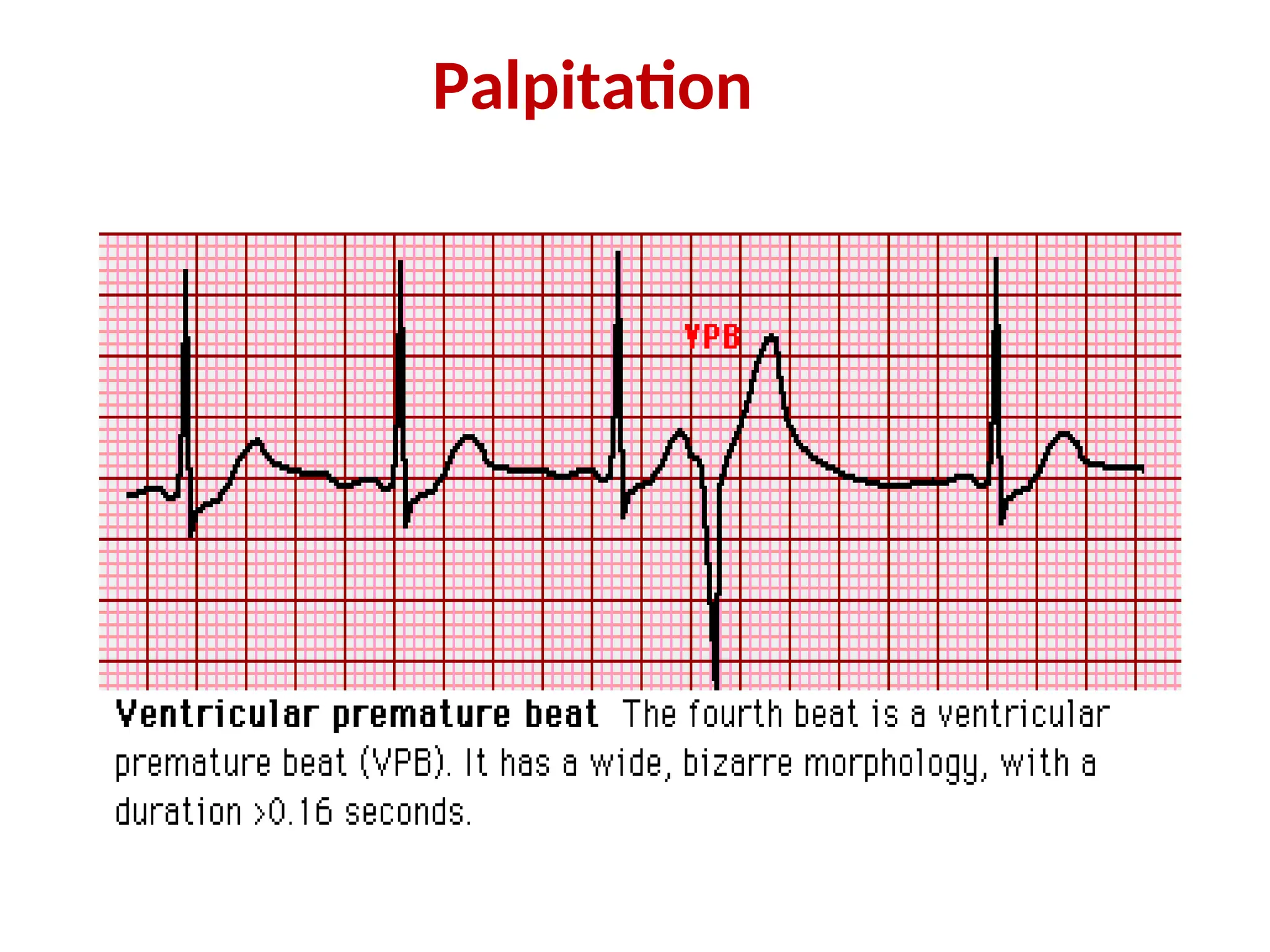 History, Symptoms and Physical Examination in Cardiovascular Disease.ppt