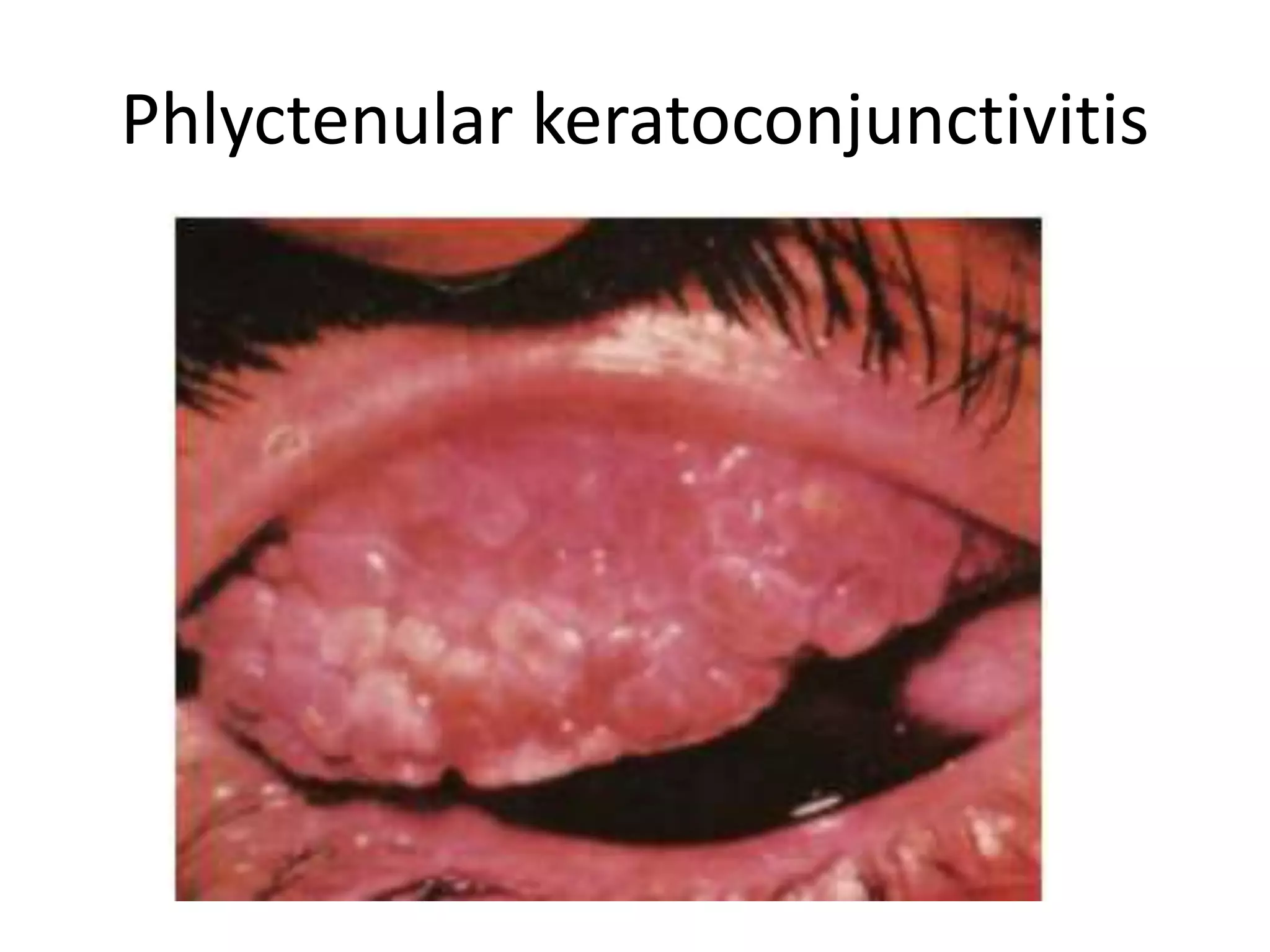 History taking and case examination OF EYE | PPTX