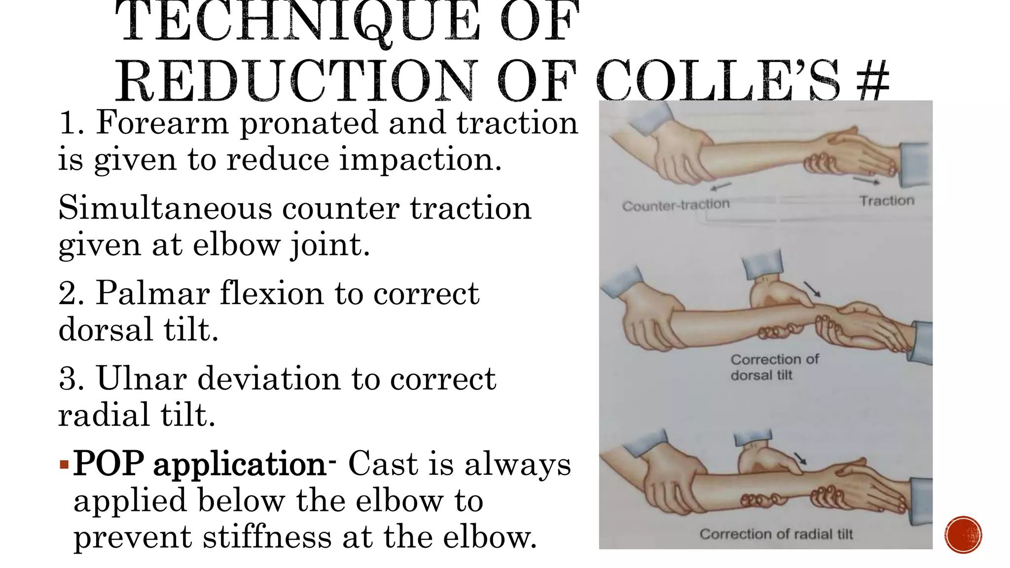 history taking and colles fracture.pptx