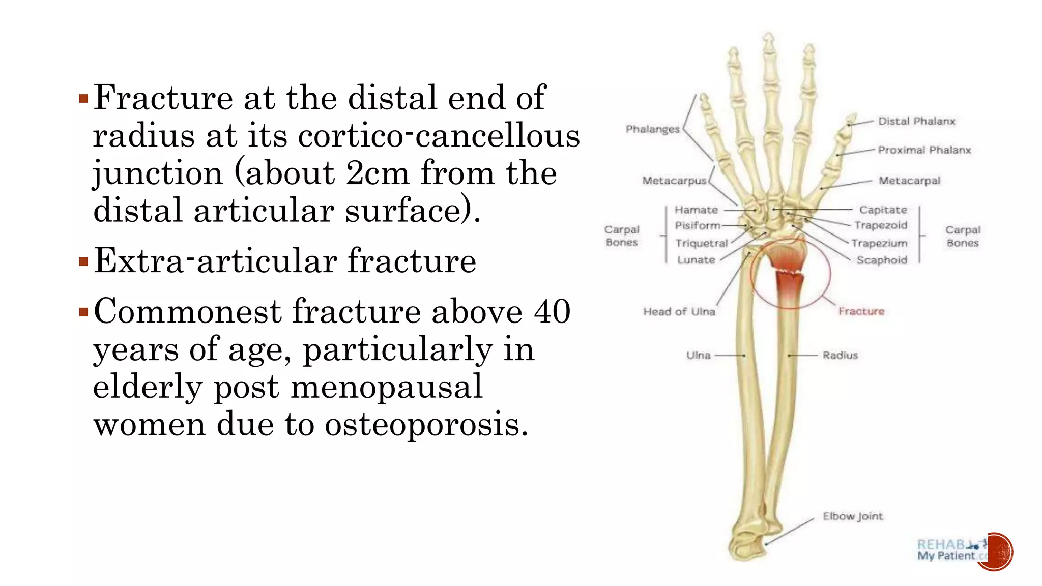 history taking and colles fracture.pptx