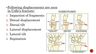 history taking and colles fracture.pptx