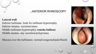 History taking and examination of nose and pns | PPT