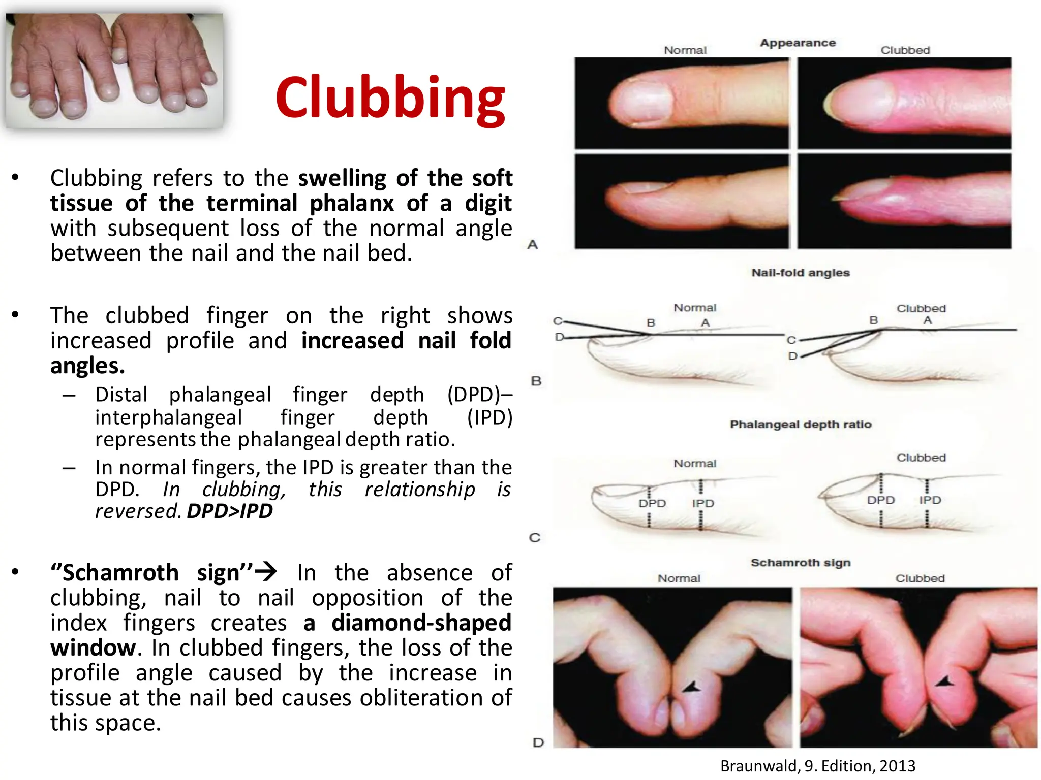 History Taking and Physical Examination of Cardiovascular System-The ...