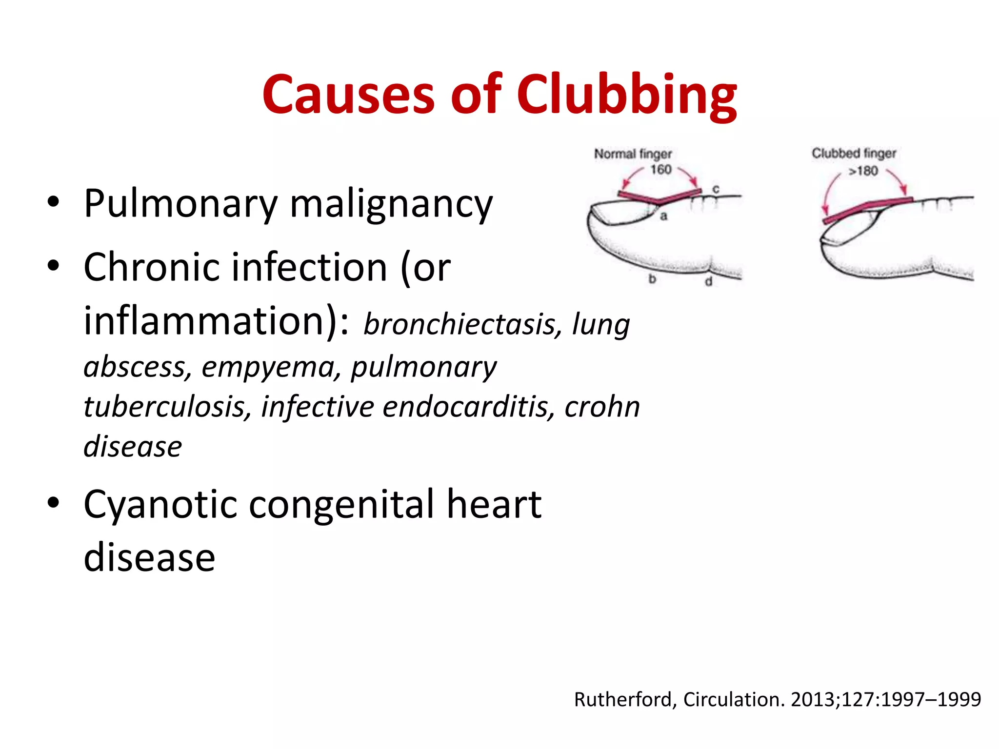 History Taking and Physical Examination of Cardiovascular System-The ...