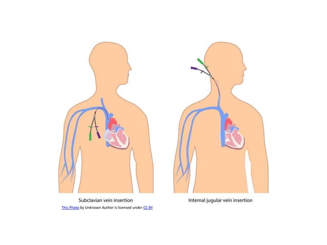 History Taking and Physical Examination of Cardiovascular System-The ...