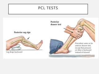 History taking and physical examination of the knee | PPTX