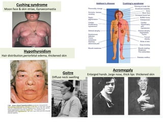 history taking Clinical assessment of endocrine system 2022.pdf
